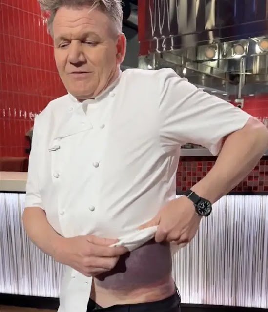 Gordon Ramsay's Surprising Response to Life-Threatening Accident!