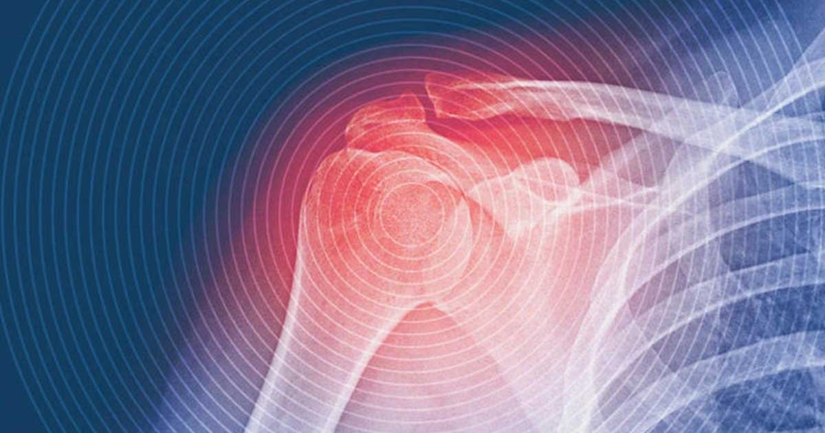 Recognizing Chronic Inflammation: 6 Warning Signs and How to Manage Them